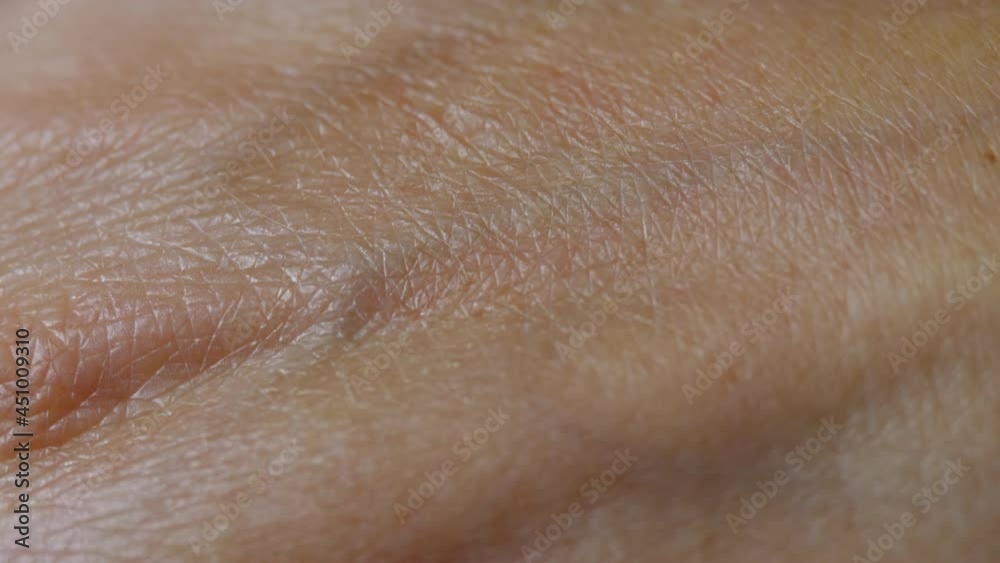 Macro Shot of Really Dry Old Human Skin. Close up Skin Texture With ...
