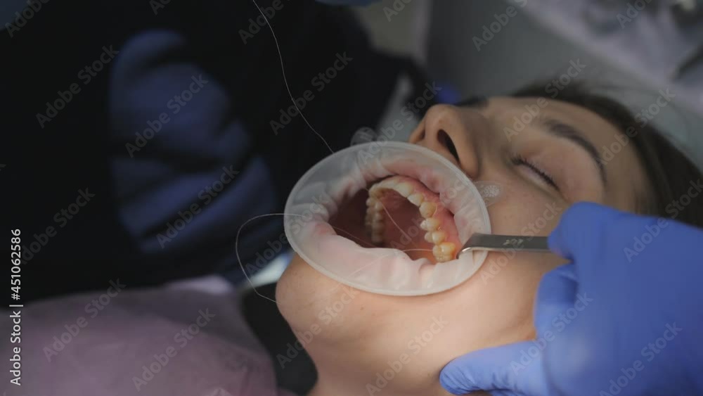 Face of patient, hands of dentist sutured wound after tooth extraction ...