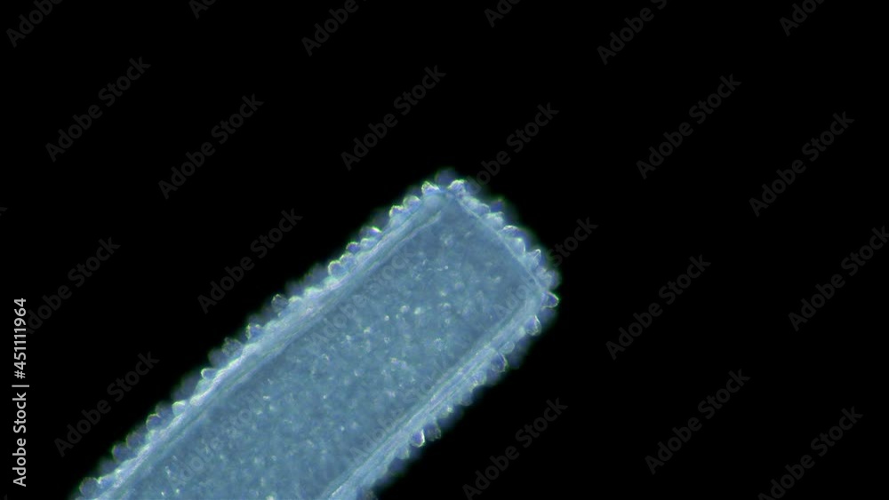 Proboscis of the worm Nemertea Prostoma sp. under a microscope from the ...