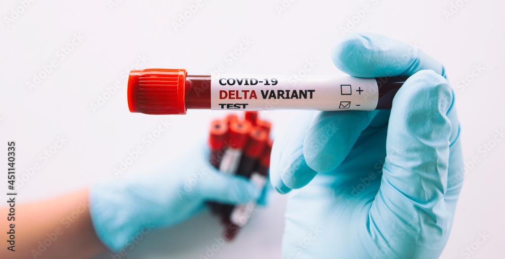 The nurse holding tube of blood negative test with the label Covid-19 ...