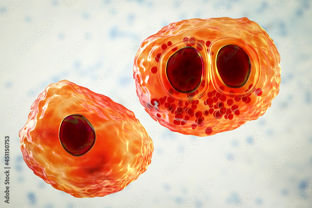 Cytomegalovirus CMV in human cell, owl's eye inclusion in nucleus Stock ...