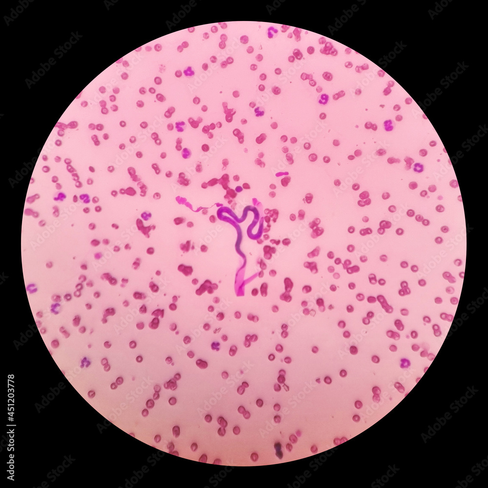 Microfilariae are sheathed in the blood smear of a dog. Light ...