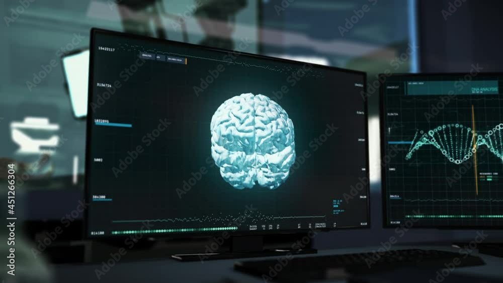 Computer Screen Displays Medical Program To Hold Patient Brain ...