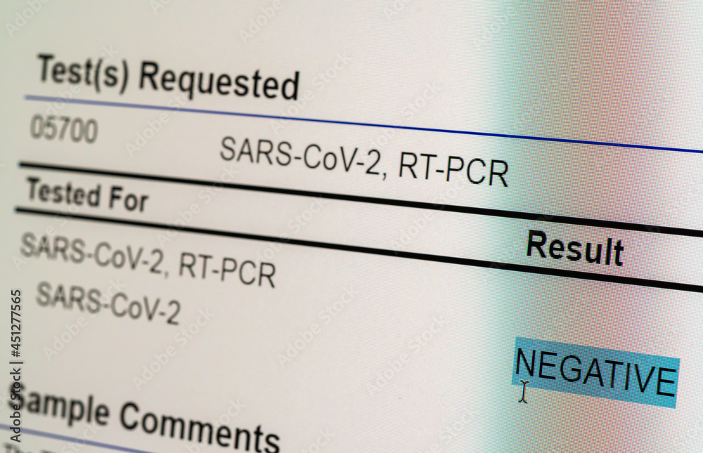 Computer screen showing a negative result for PCR test on nasal swab ...