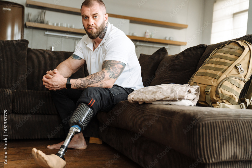 Photo & Art Print Mid aged white man with prosthetic leg, Drobot Dean