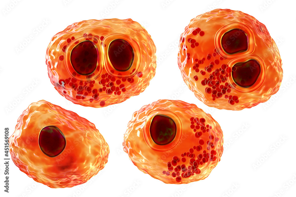 Cytomegalovirus CMV in human cell, owl's eye inclusion in nucleus Stock ...