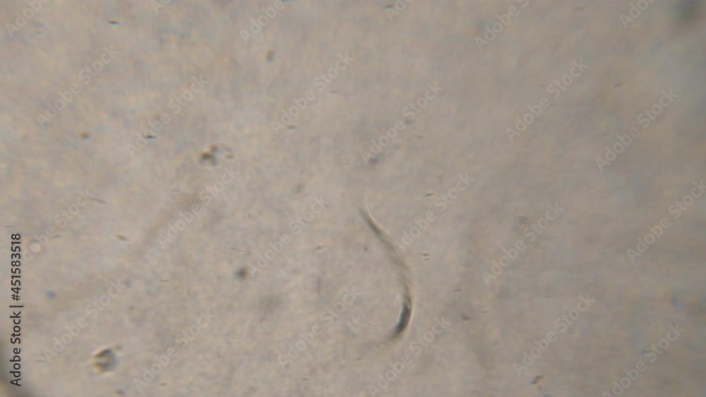 Bacteria Parasites and Worms in drinking Water under Microscope ...