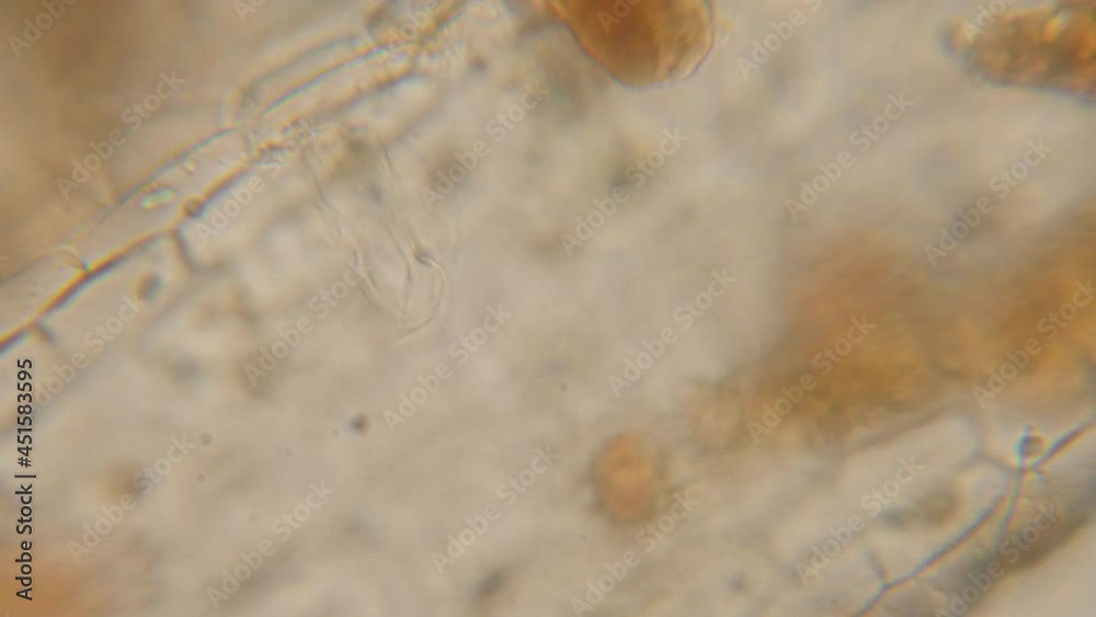 Chloroplast Under a Microscope Dead Plant. Cell Division. Dead Plant ...