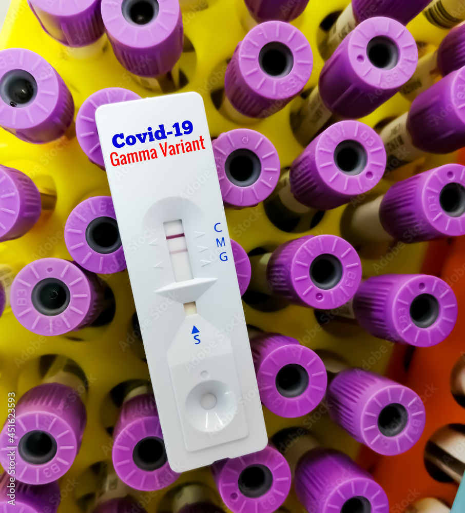 Rapid test cassettes for Covid-19 variant testing, Gamma variant Stock ...