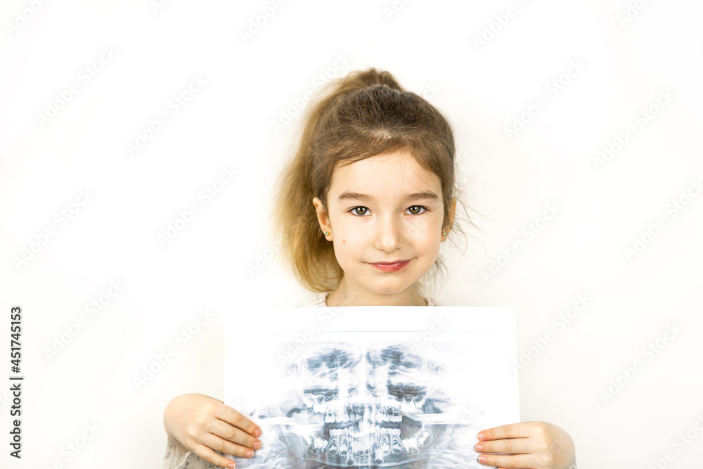 Foto de Girl holds her X-ray with a panorama of baby teeth and the ...