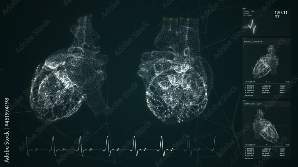 Dynamic pulsating heart. MRI scanning. Heart beat line. Cardiogram ...