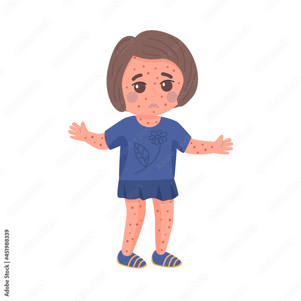 Little girl having chickenpox clipart. Isolated on white background ...