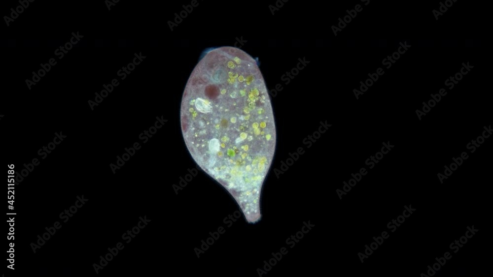 Stentor Ciliophora Infusoria under microscope, family Stentoridae ...