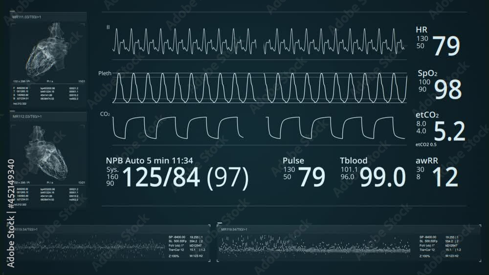 MRI scanning. Dynamic Heart beat line, pulsating heart. Cardiogram ...