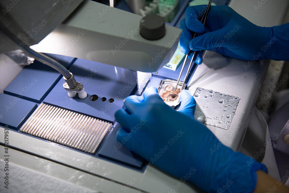 Medical scientists are placing biopsies for pathological examination ...
