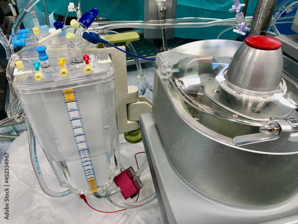 Venous Reservoir And Oxygenator Connected With Heart Lung Machine By Tubing Circuit For