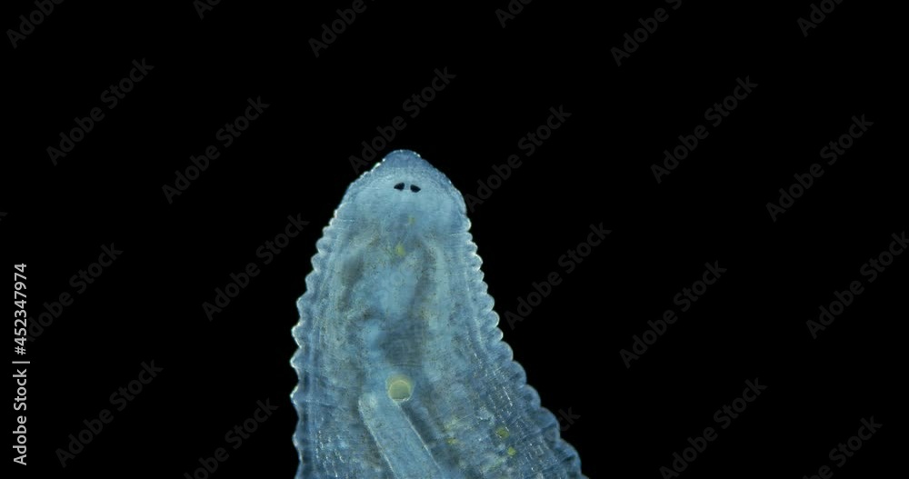 Leech family Glossiphoniidae under a microscope. Possibly species ...