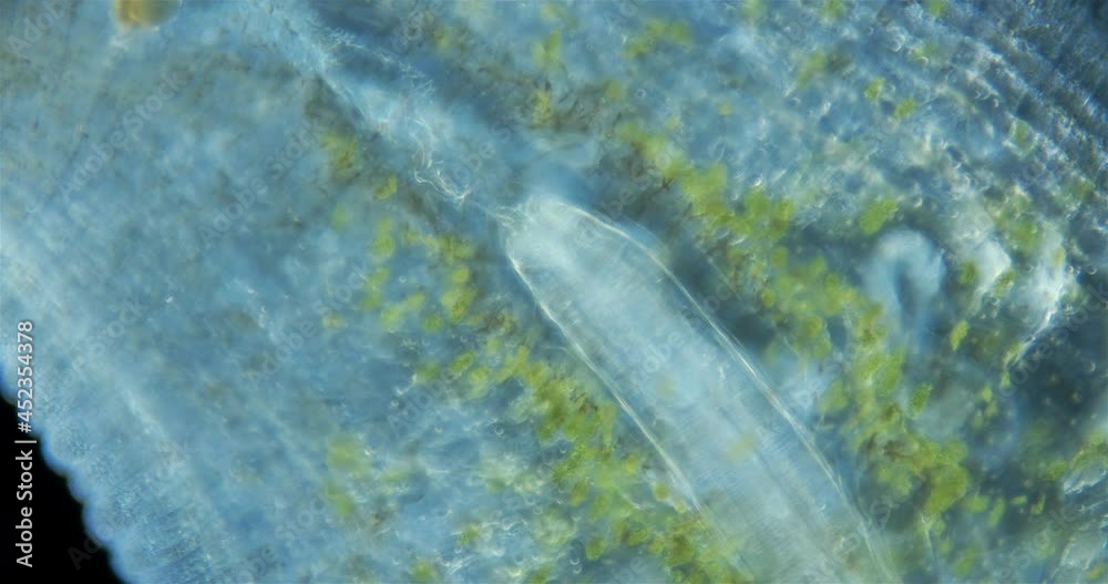 Leech family Glossiphoniidae under a microscope. Possibly the species ...