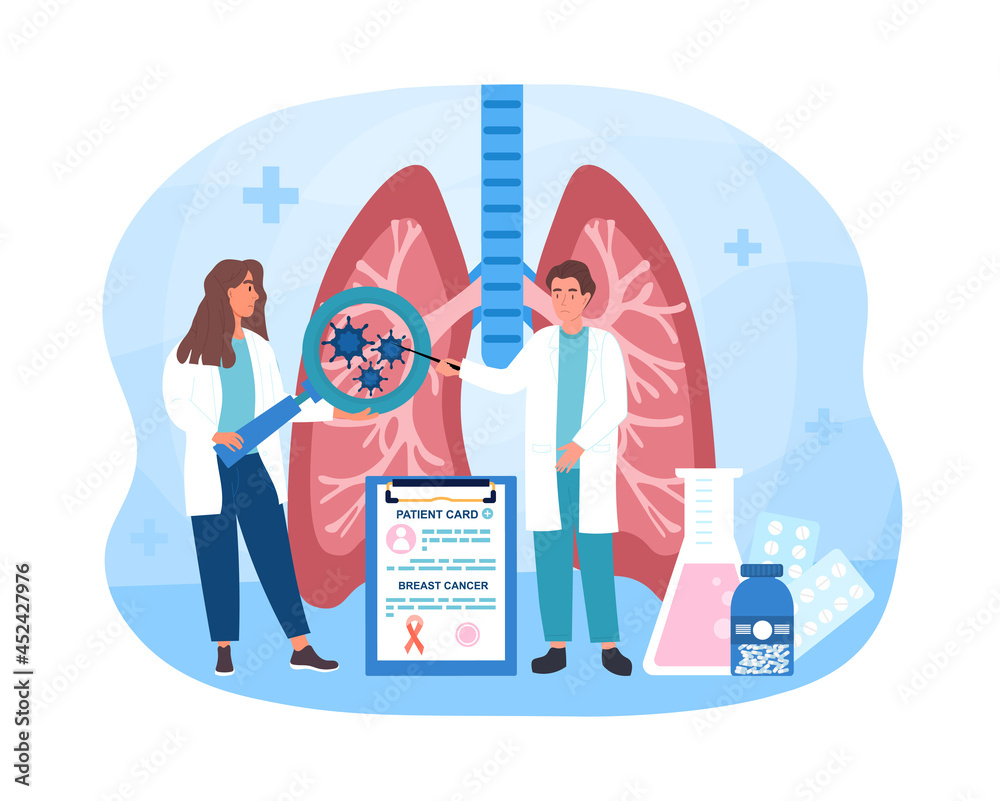 Lung cancer concept. Doctors examine patient lungs and make diagnosis ...