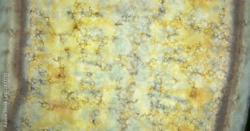 Leech family Erpobdellidae under a microscope, order Arhynchobdellida. Possibly genus Erpobdella ...