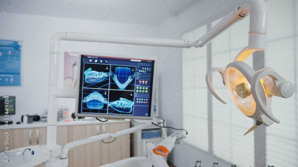 Closeup of stomatology teeth xray images on monitor revealing teethcare ...