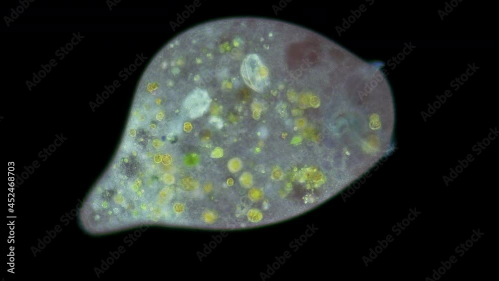 Stentor Ciliophora Infusoria under microscope, family Stentoridae ...