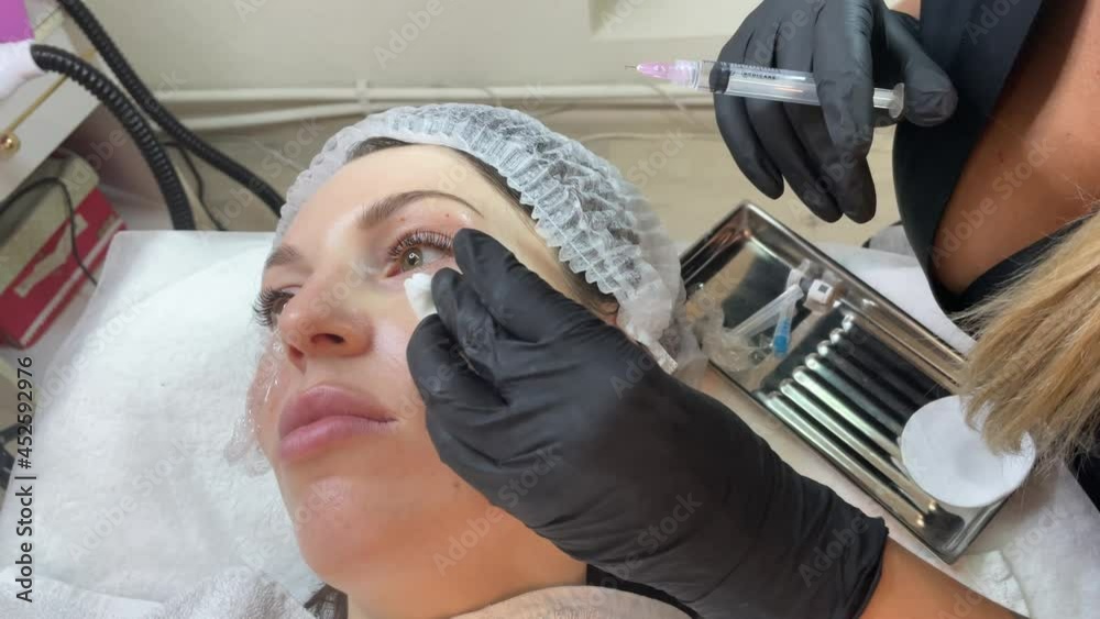 Cosmetologist doctor is making multiple injections biorevitalization ...