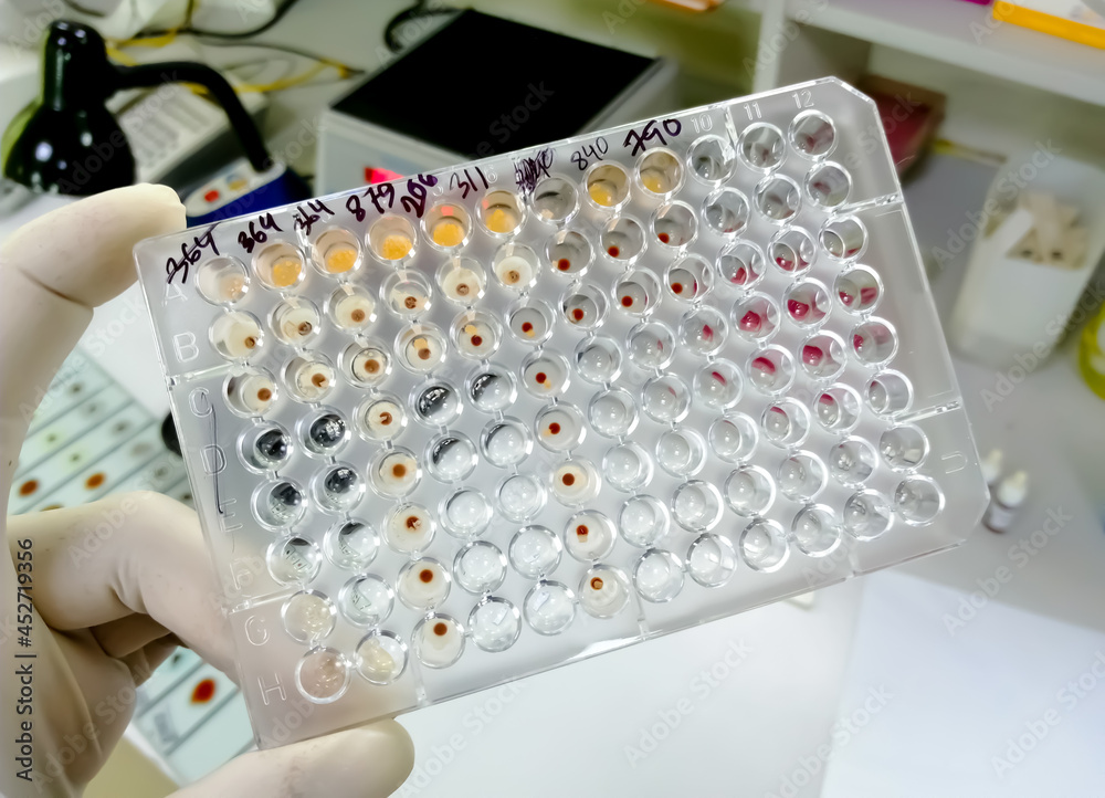 Hemagglutination assay for T. pallidum antibodies. TPHA. ELISA plate ...