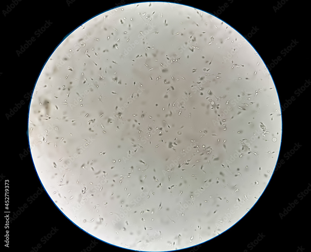 Sperm Morphology Semen Photo Under Microscope Micrograph Showing