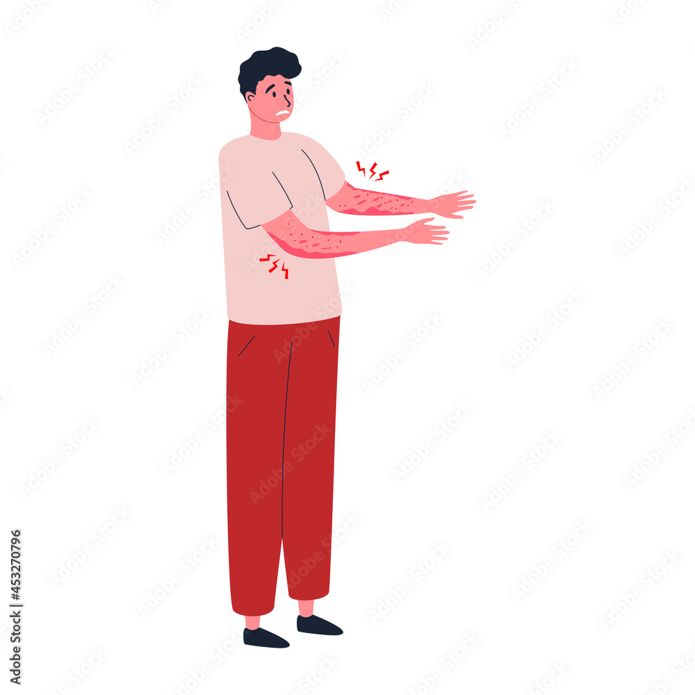 A flat illustration of a standing unhappy suffering person scratching ...