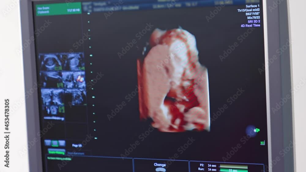 Pictures of fetus on the screen of monitor. Scientific analysis ...