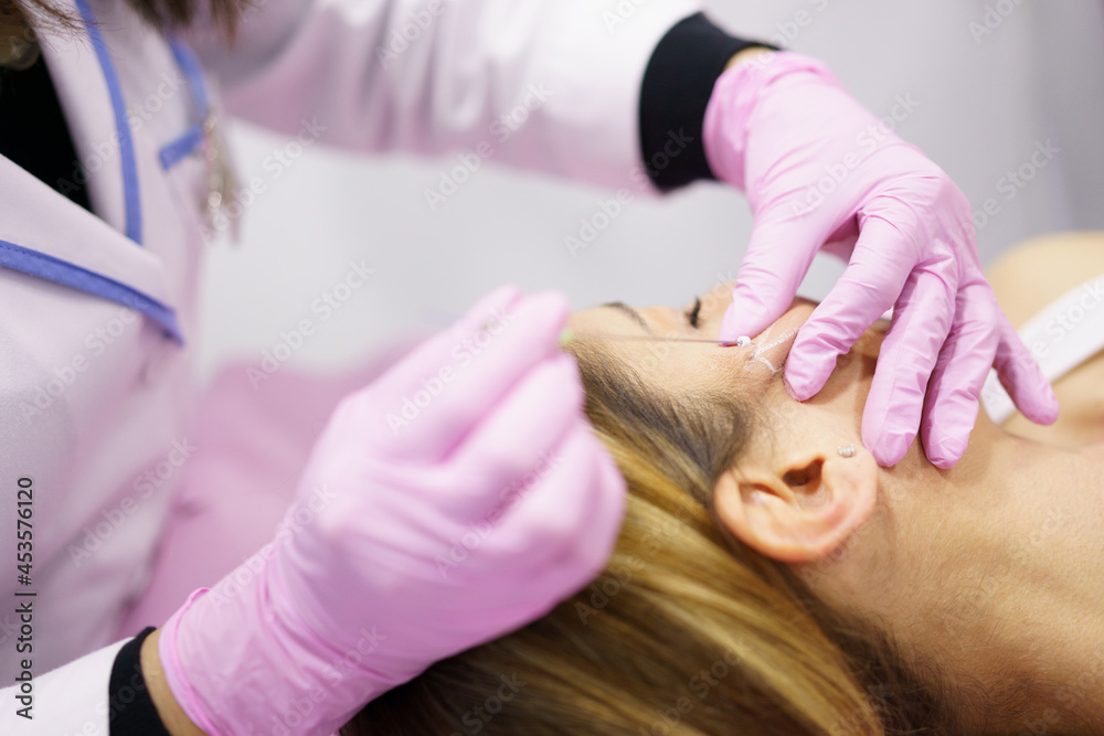 Doctor injecting PDO suture treatment threads into the face of a woman ...