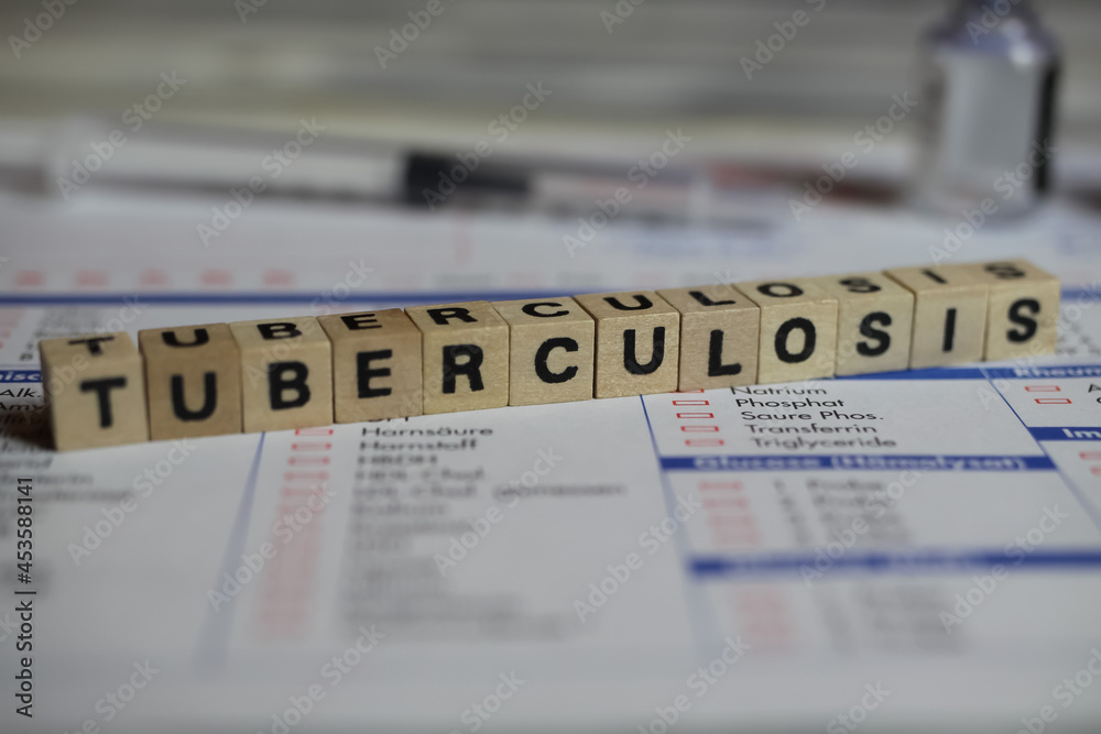 Viersen, Germany - June 1. 2021: Closeup of word tuberculosis on ...