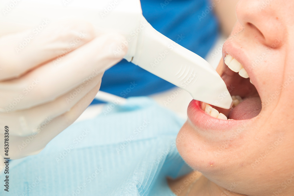 Close up detail of a dentist mouth scanner in action. Stock Photo ...