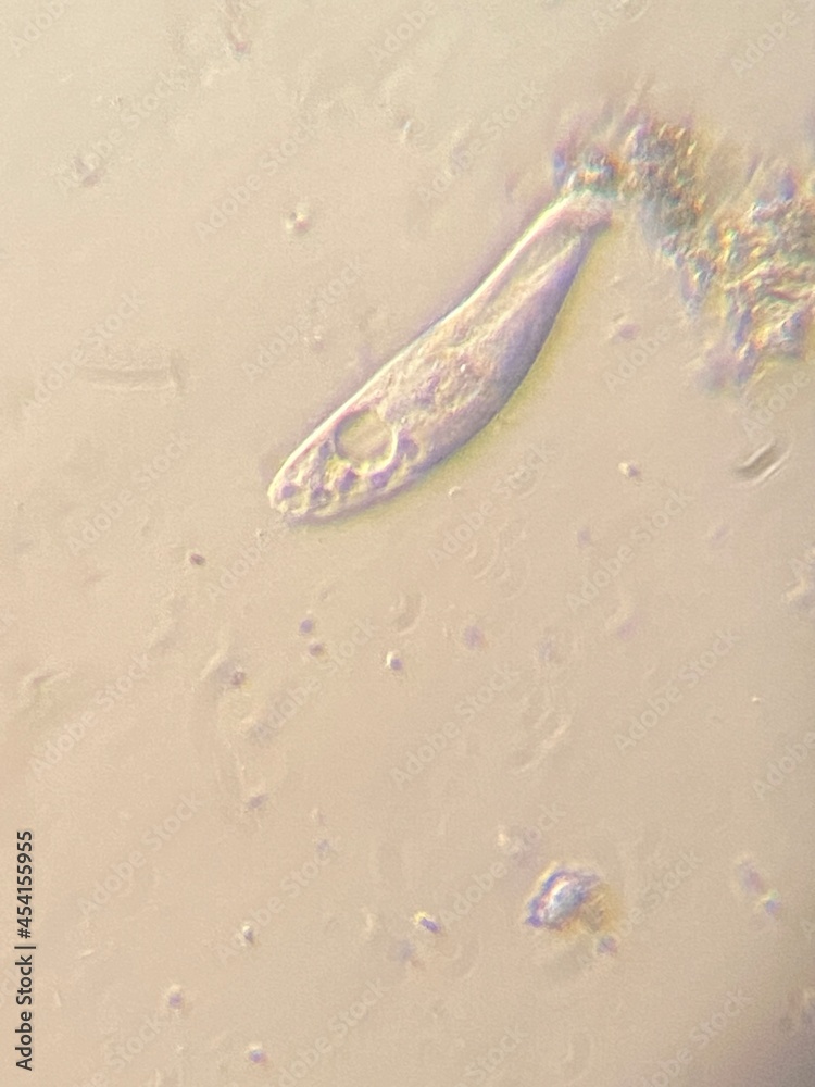 microscopic photo of paramecium in water sample from the pool Stock ...