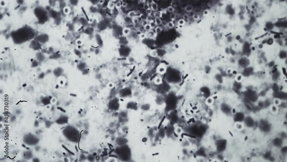 Abstract bacteria and microbes under the microscope. Fungus or mold is ...