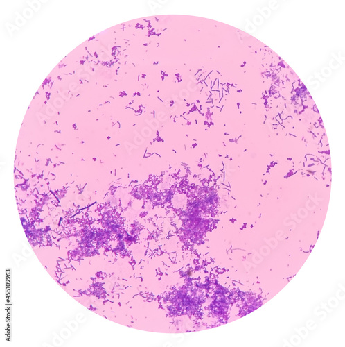 Cocci and bacilli bacteria in urine under 100X light microscope. Smear ...
