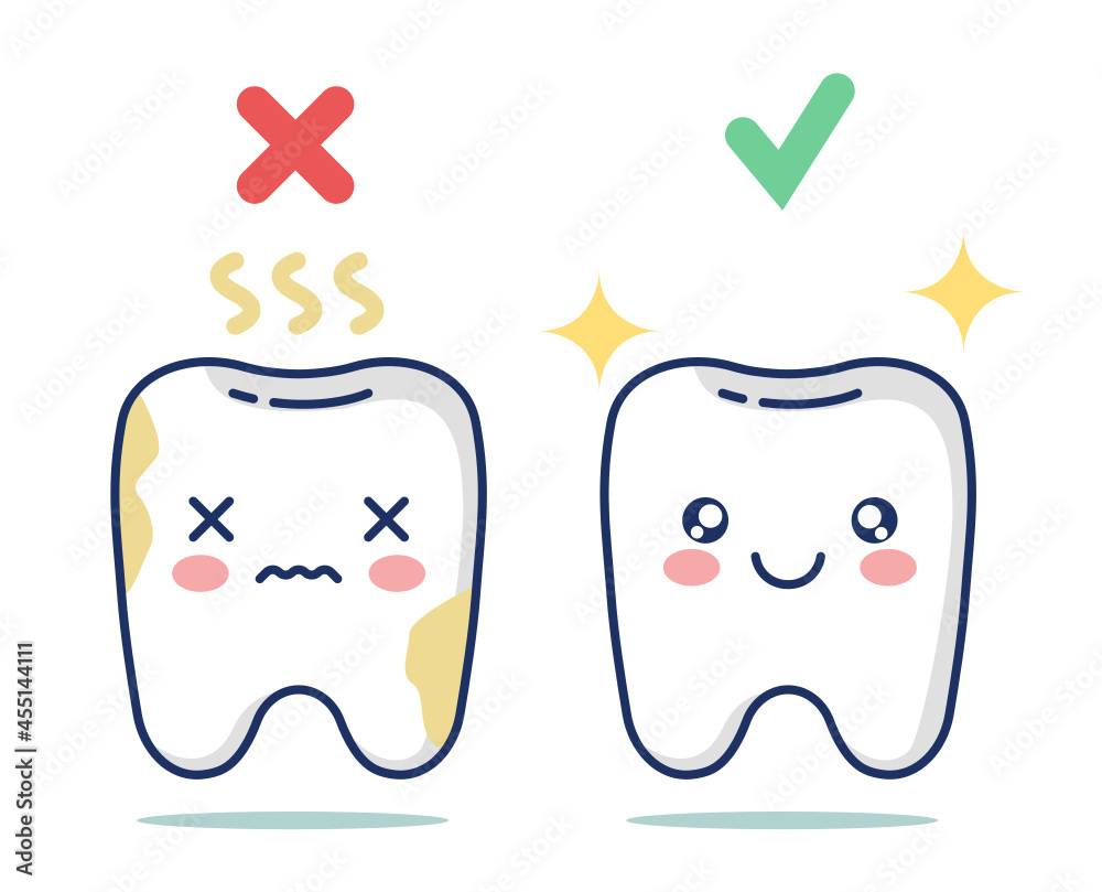 Cartoon tooth dental illustration for kids. Comparison concept. Dirty ...