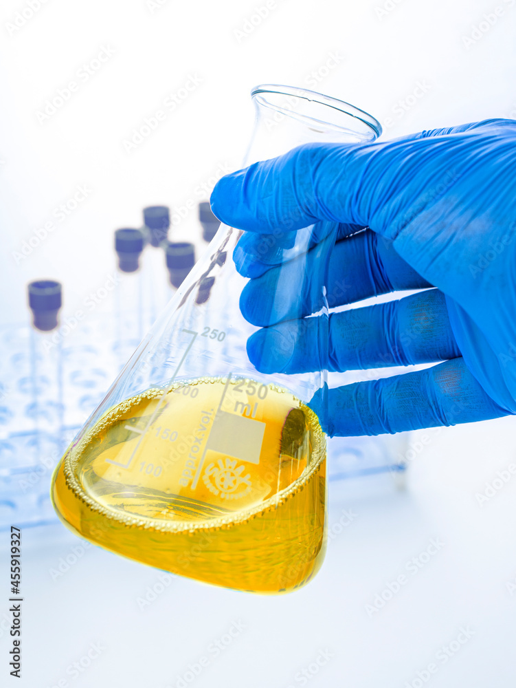 Urine analysis in the laboratory. Medical urine test. Urine sample for ...