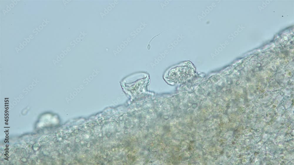 Parasitic ciliate of family Trichodinidae under a microscope, Order ...