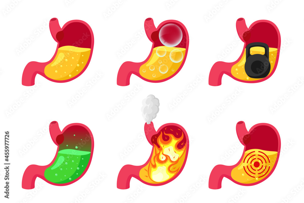 Stomach heartburn, bloating, heaviness, poisoning, ulcer and healthy ...
