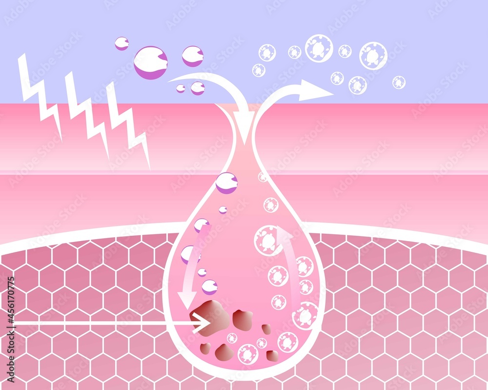 Desincrustation Procedure. Galvanic Skin Cleansing Stock Vector | Adobe ...