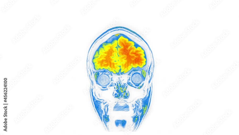 Computed medical tomography MRI upscaled scan of healthy young female ...