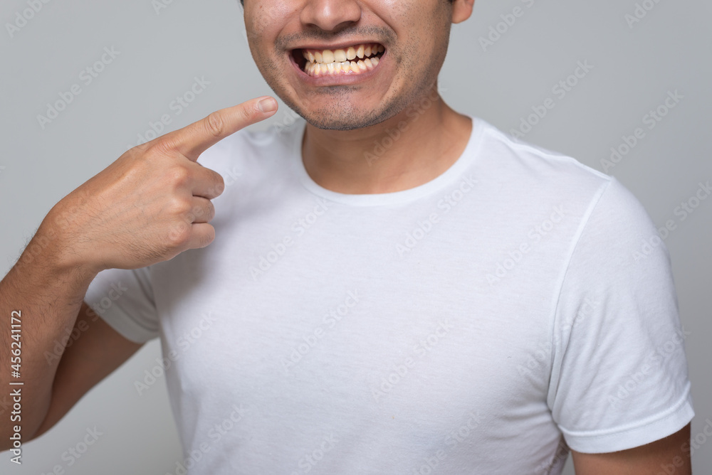 Hispanic-looking Mexican man with yellow teeth, Chinese-haired young ...