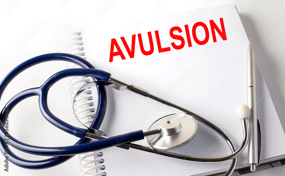 Notebook with text AVULSION with pen and stethoscope, medicina Stock ...