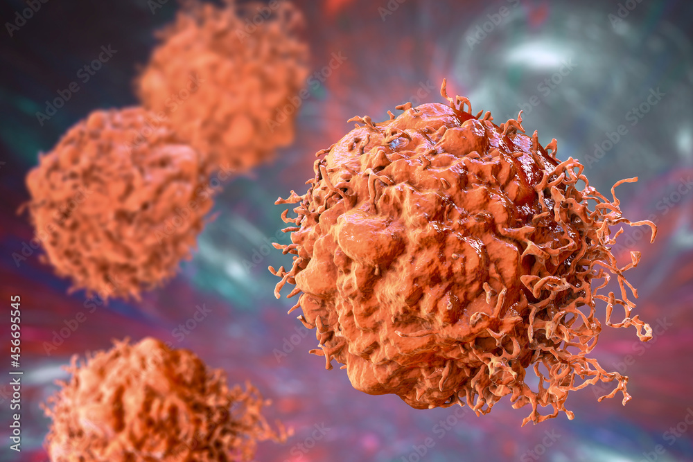 Cancer cells, 3D illustration Stock Illustration | Adobe Stock