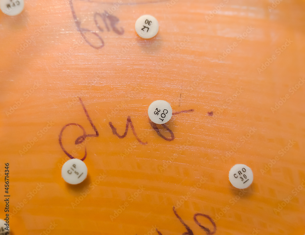 Antimicrobial susceptibility testing in petri dish, Susceptibility of ...