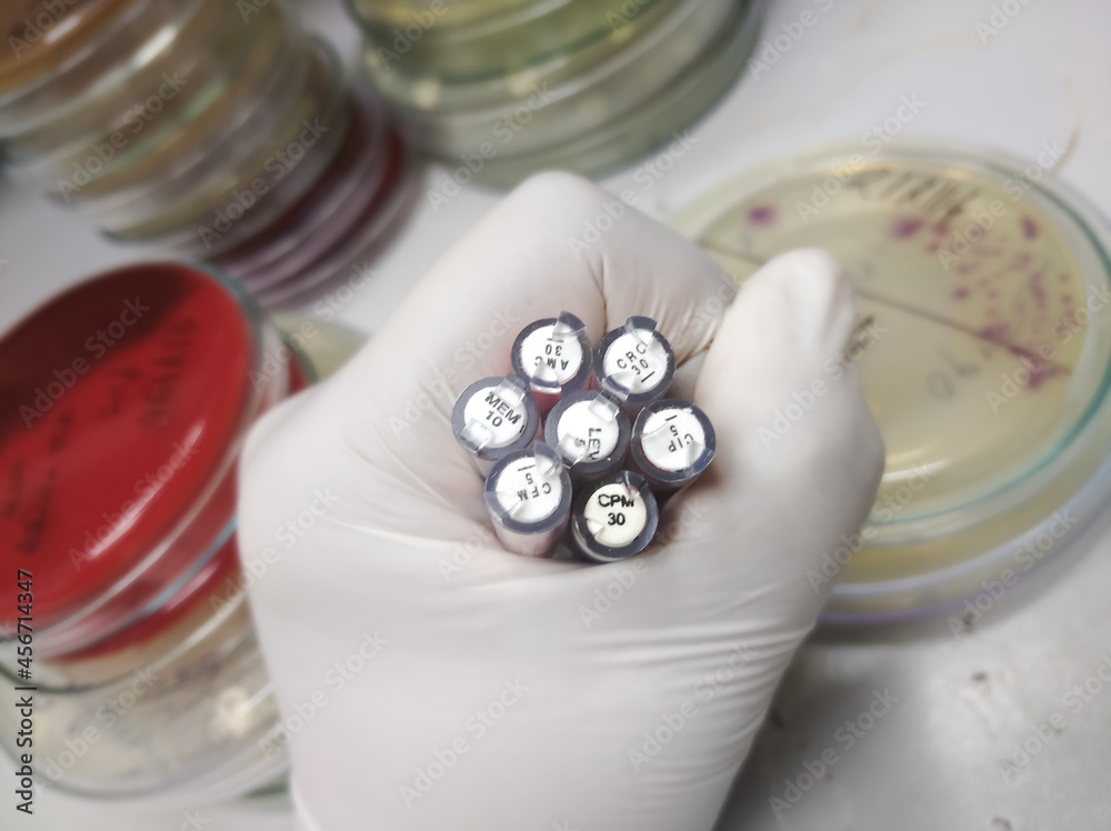 Antibiotic susceptibility testing disk use at microbiology laboratory ...