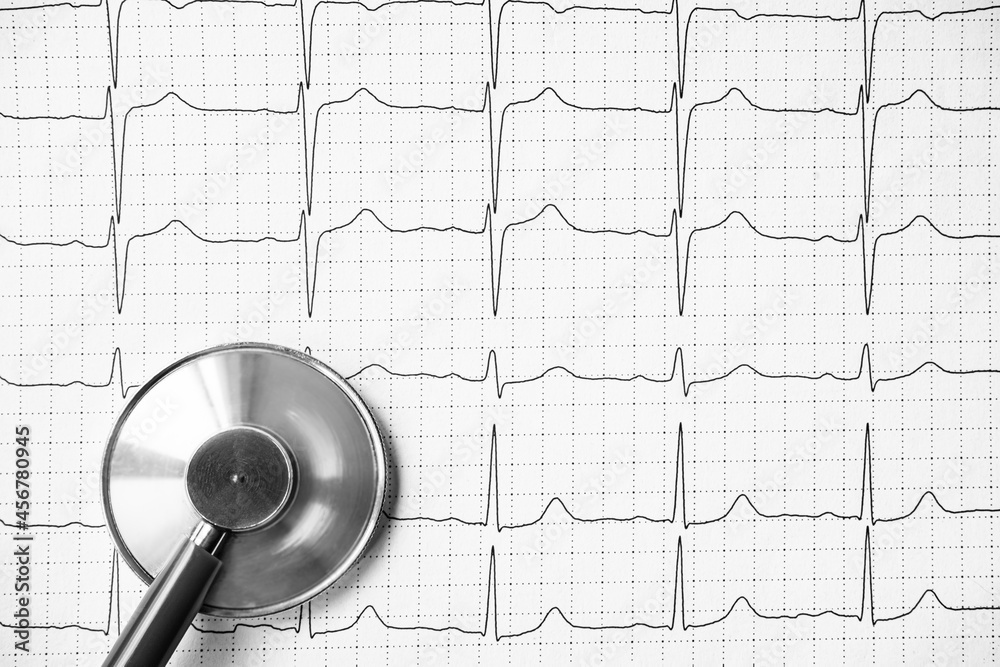 Stethoscope on the electrocardiogram (ECG) graph (top view). EKG ...