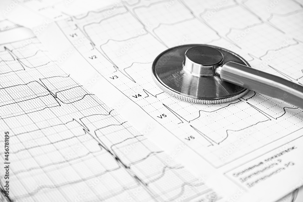 Stethoscope on the electrocardiogram (ECG) graph (top view). EKG ...